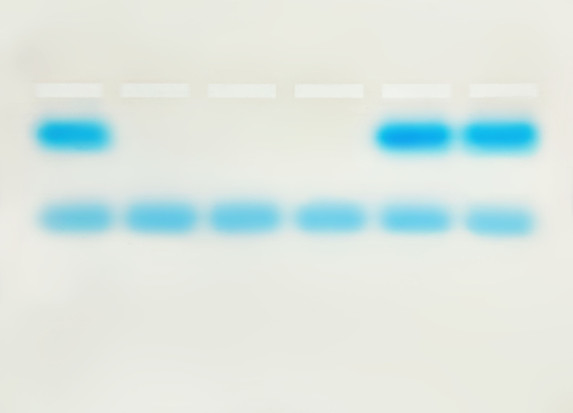 Teach Gel Electrophoresis and Core Biology with Safe, Hands-On Dye Labs ...